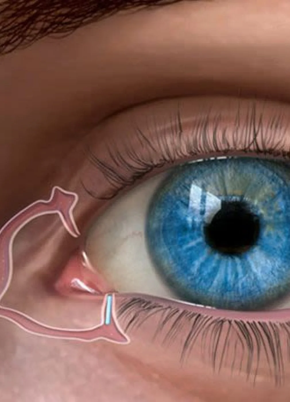 Dry Eye — Horta-Santini Eyecare