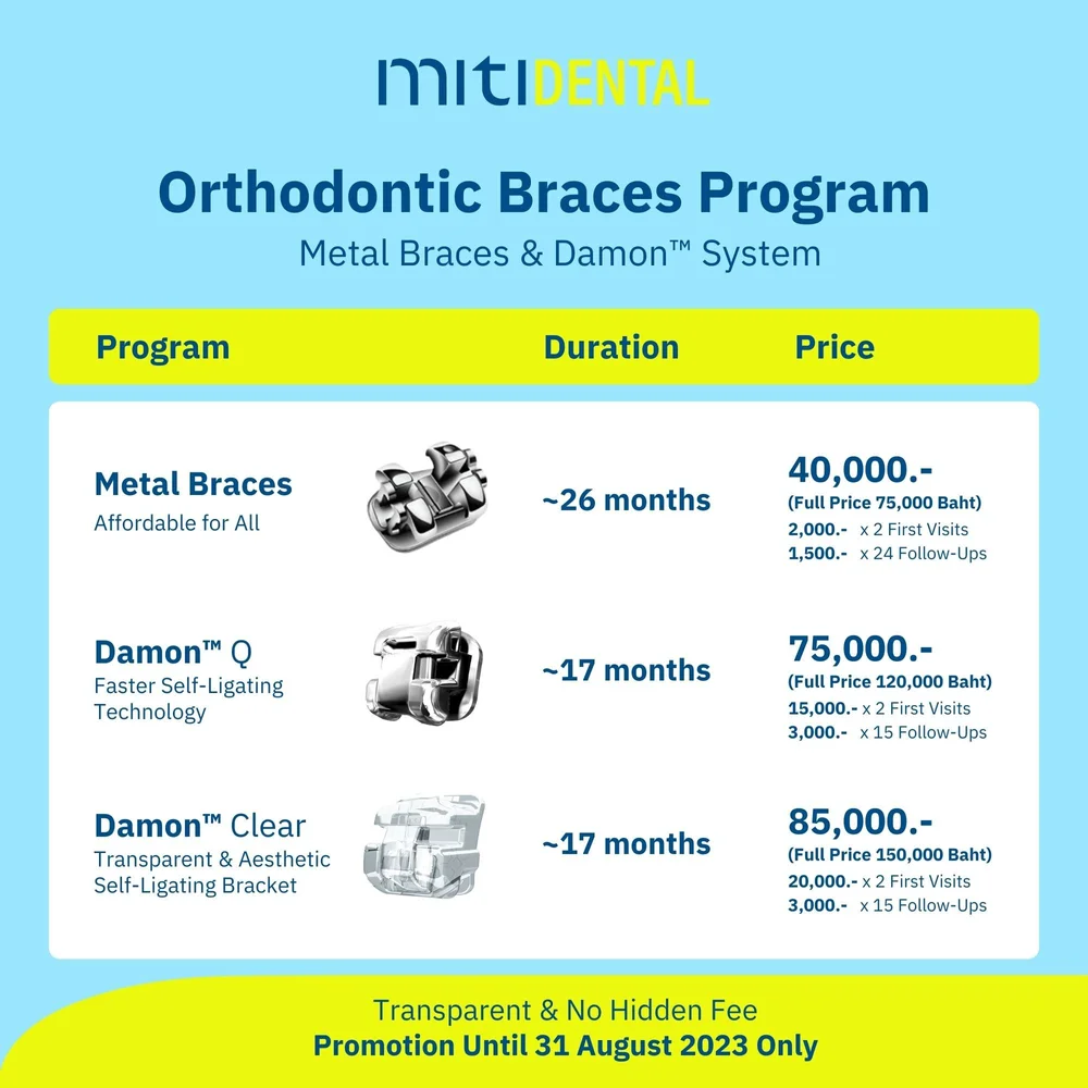 Dental Promotion & Offers — MITI Dental