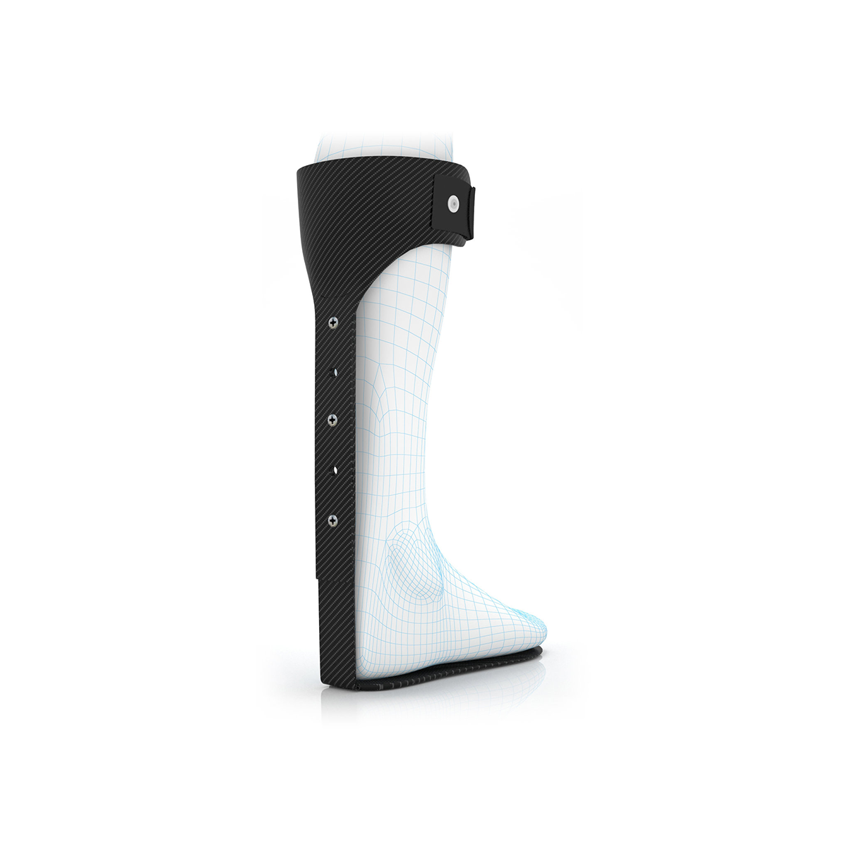 Carbon Fiber — O&P Solutions