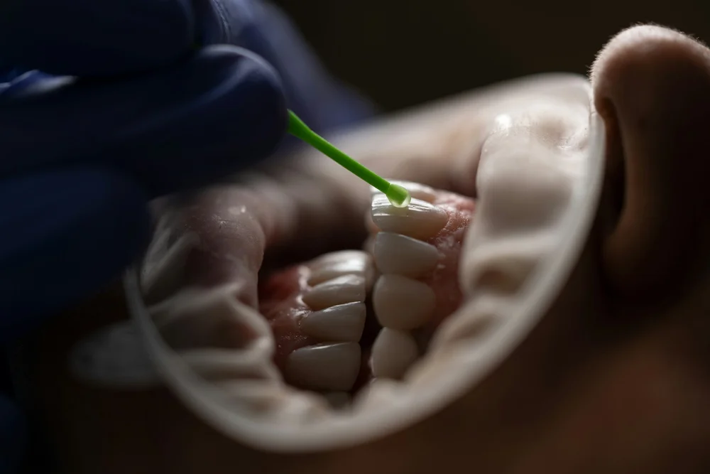 Loose Tooth? Causes, Treatments, and Prevention — Coral Reef Dental