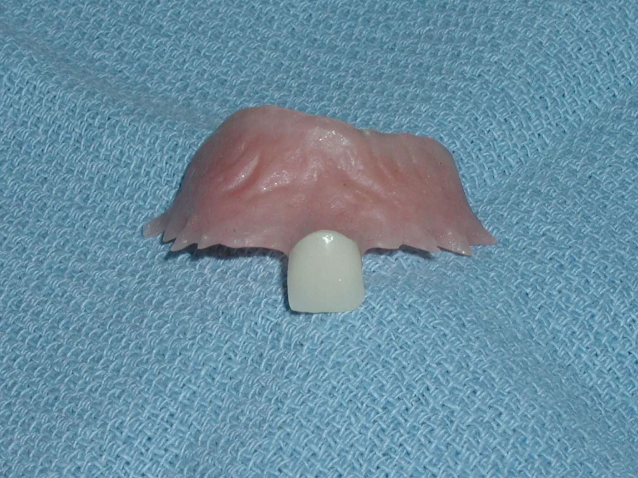 What is a Dental Flipper? Pictures of a Flipper — Coral Reef Dental