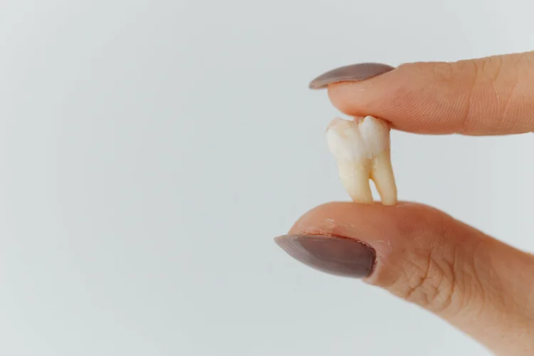 Temporary Crown Fell Off? What You Can Do Immediately — Coral Reef Dental