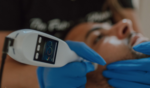 Jet Plasma Pen | Transform Your Skin Today — Calm Spirit Integrative ...