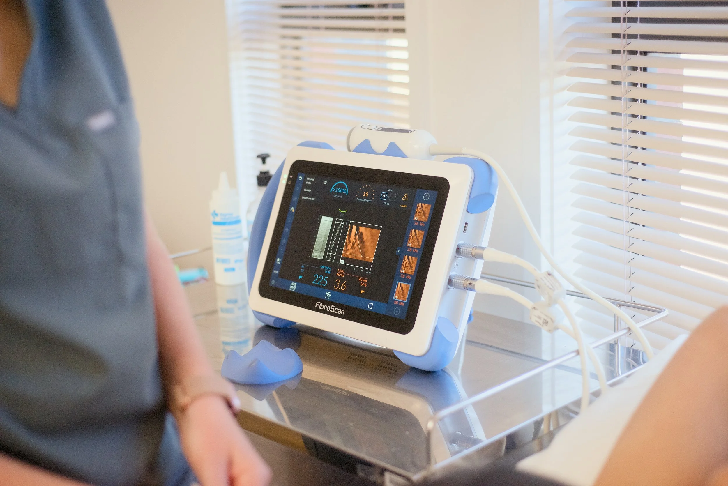 LiverHealth FibroScan Melbourne | Non-Invasive Liver Assessment – GSC ...