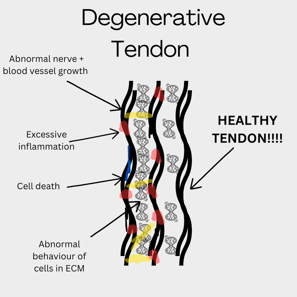 What is a Tendinopathy? — Maximise Physiotherapy Clinic
