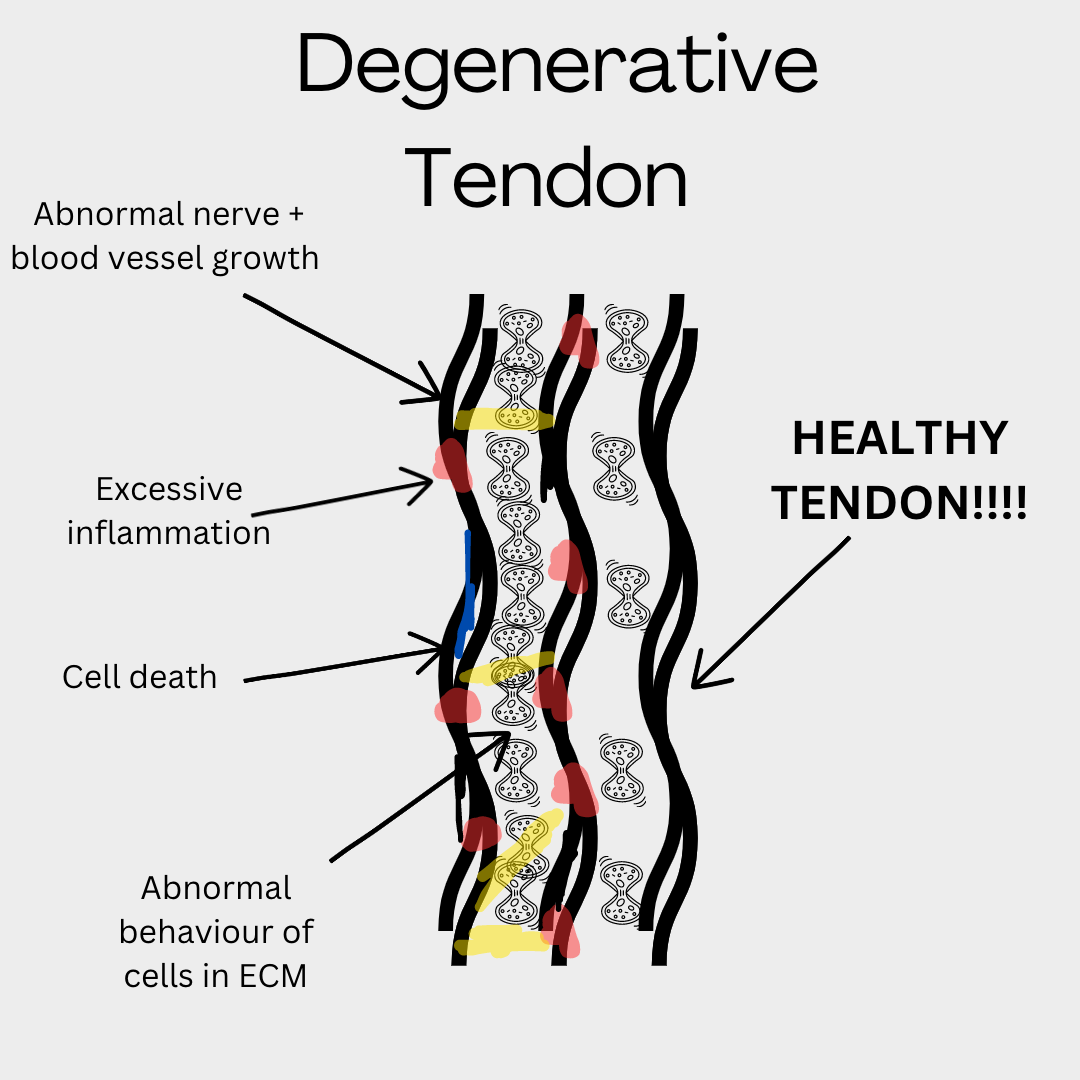 What is a Tendinopathy? — Maximise Physiotherapy Clinic