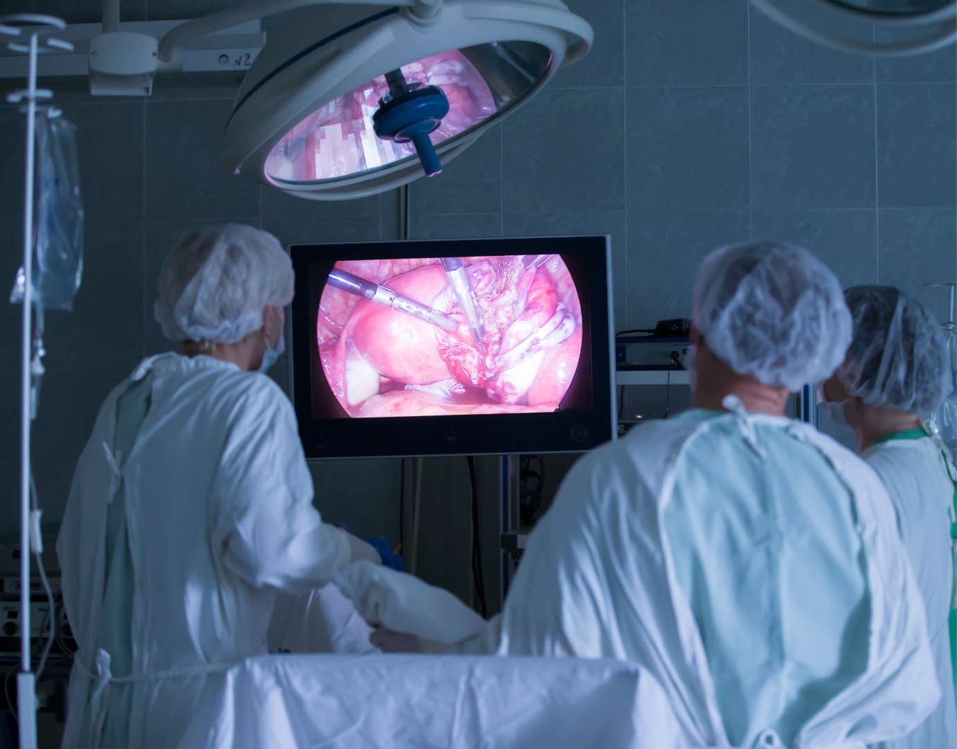 Laparoscopy For Pelvic Pain in Sydney - Dr. I-Ferne Tan