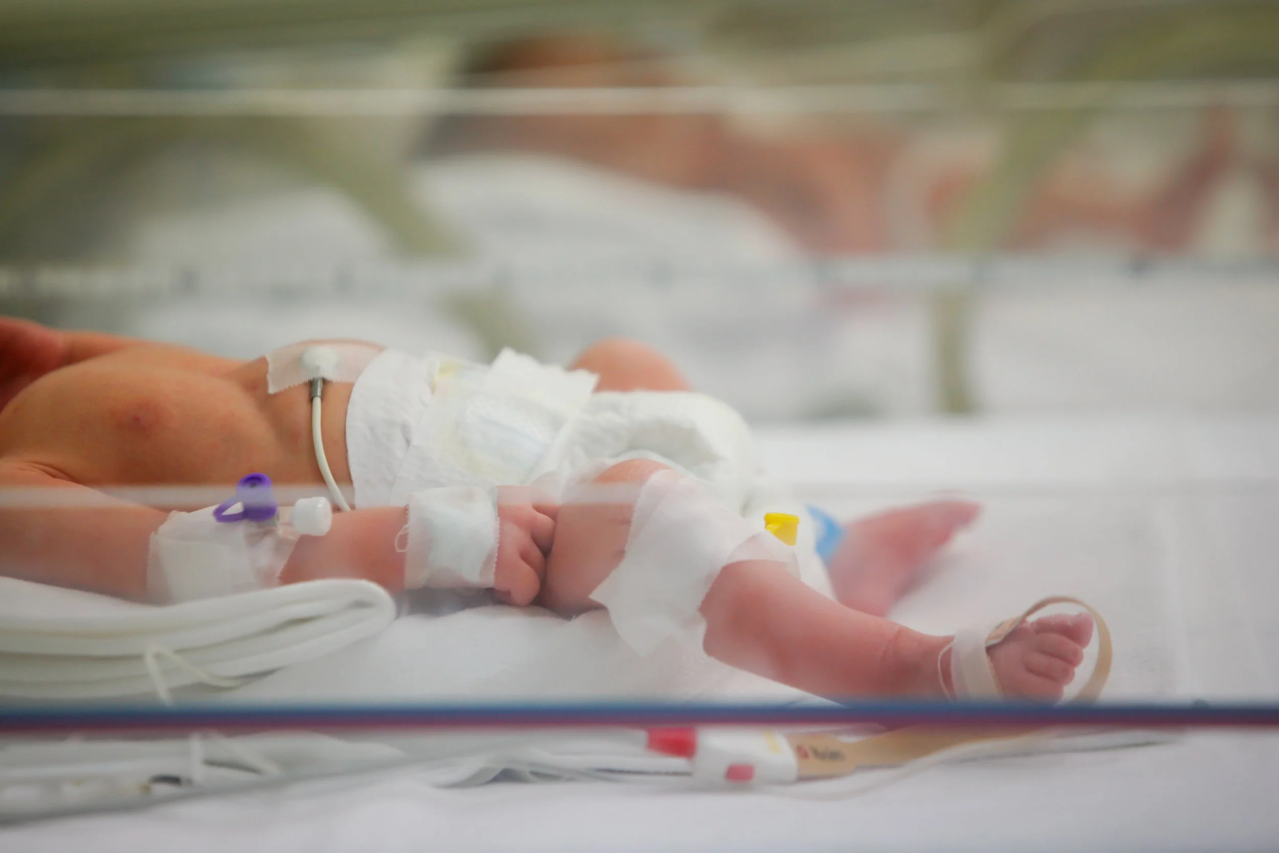 Feeling Overwhelmed and Intimidated in the NICU: How to Cope and Find ...