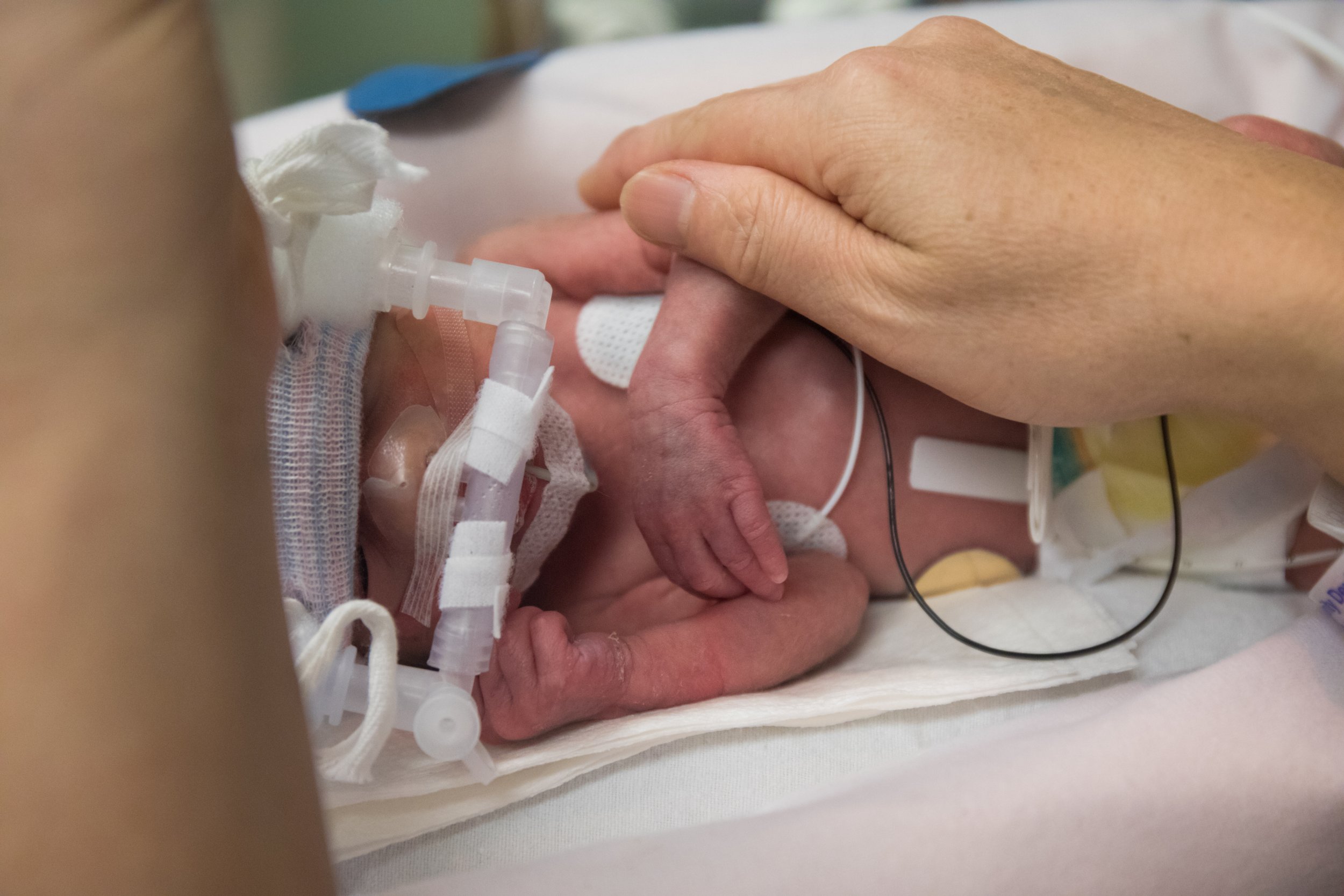 Understanding Infant CPAP in the NICU: A Lifesaving Tool for Premature ...