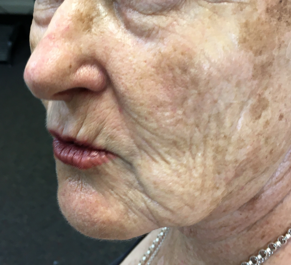 Pigmentation | Skin Concerns and Treatments — Aesthetica Skin Treatments