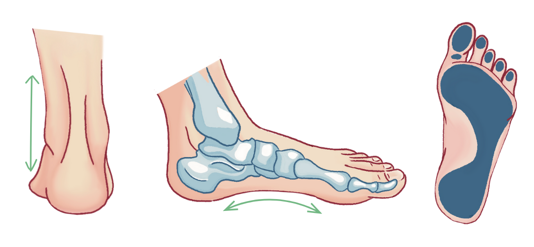 Understanding Your Foot Arch — Affinity Podiatry