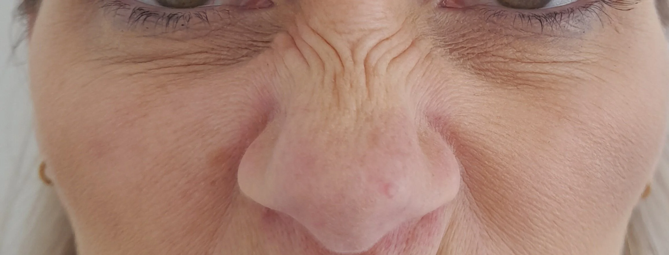 Treatments — Dr. Sheila Byrne