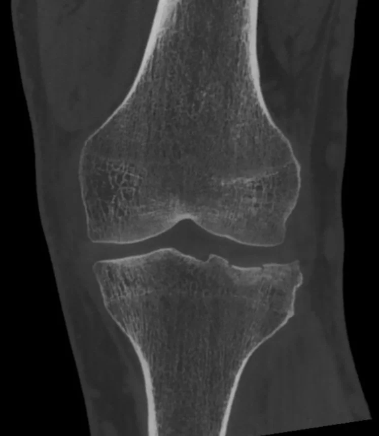 Cone-beam CT | Ervaar geavanceerde beeldvorming — Radiologiepraktijk