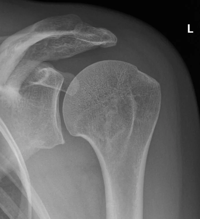 RX | Plan vandaag een bezoek — Radiologiepraktijk