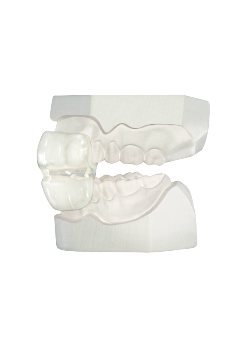 Thermo-Splint | Enhance Comfort, Improve Retention — O'Brien Dental Lab