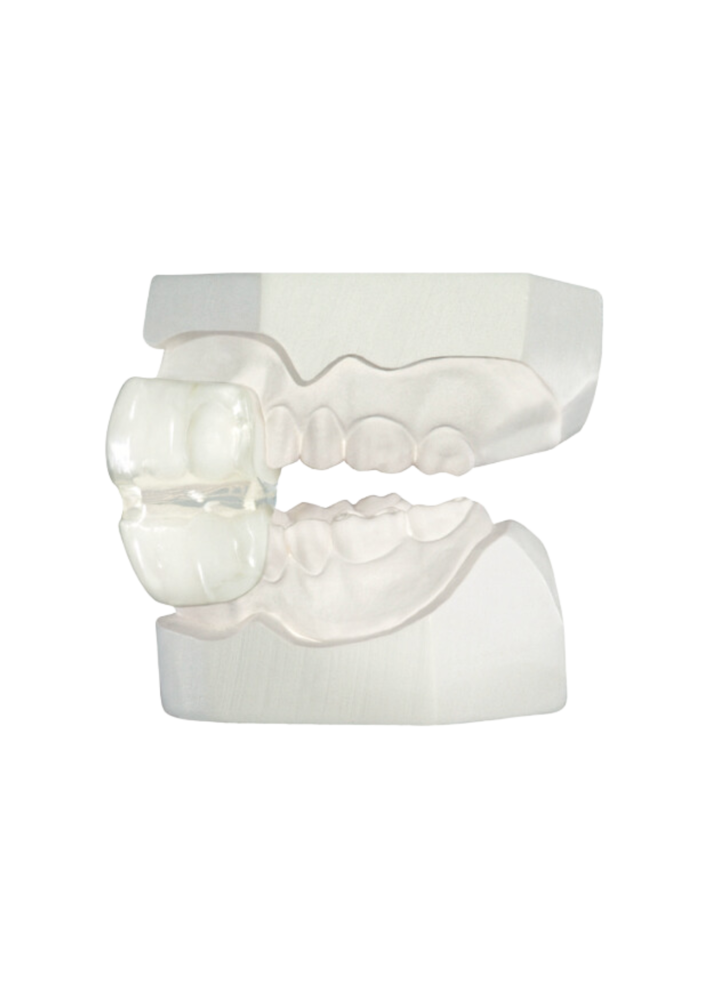 Thermo-Splint | Enhance Comfort, Improve Retention — O'Brien Dental Lab
