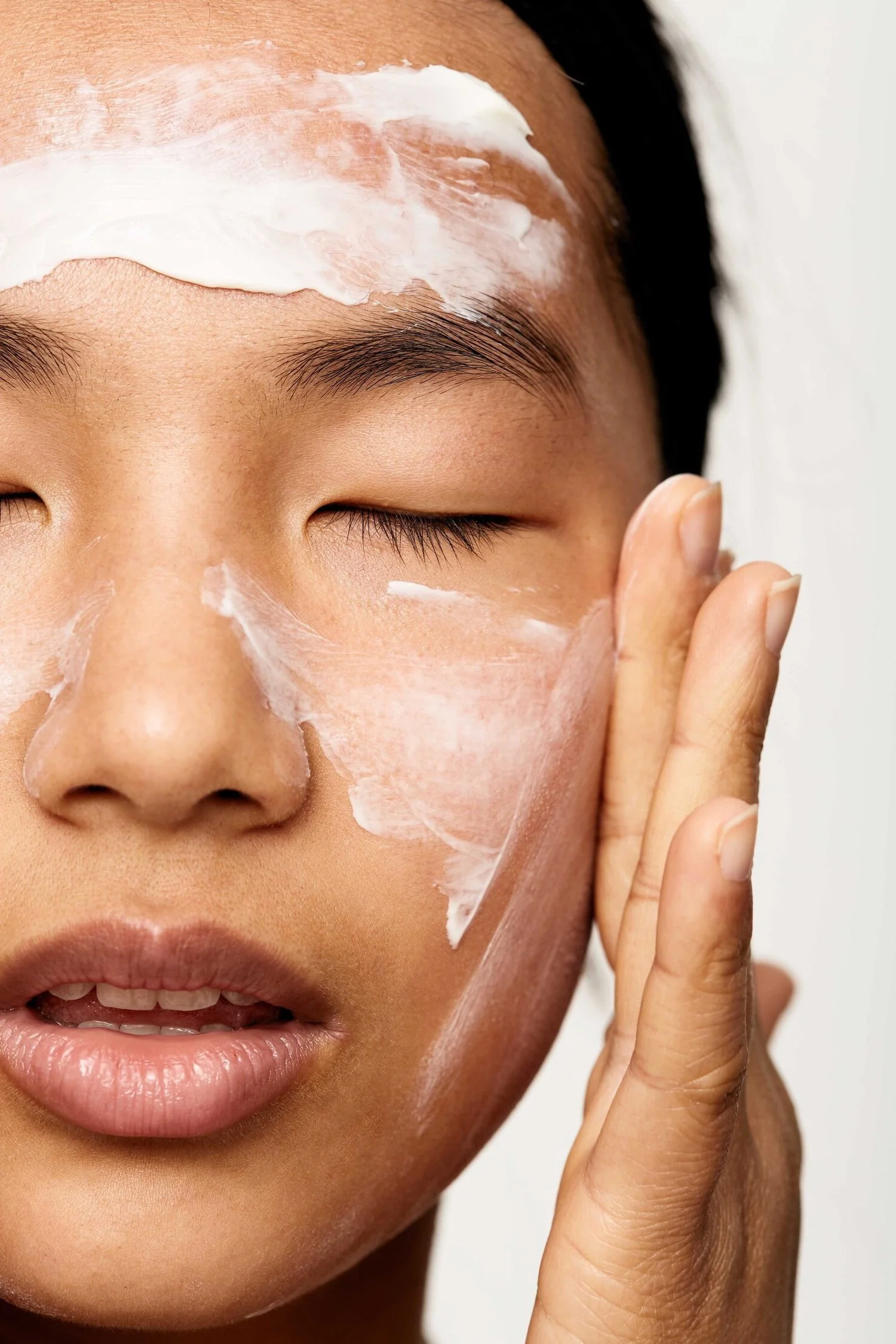 Microneedling (Dermal Needling) — nelson skin clinic