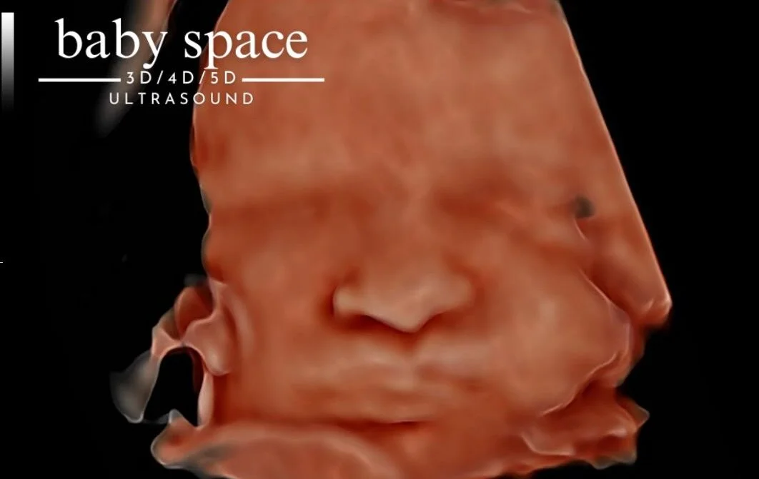 Baby Space - 3D/4D/5D ultrasound