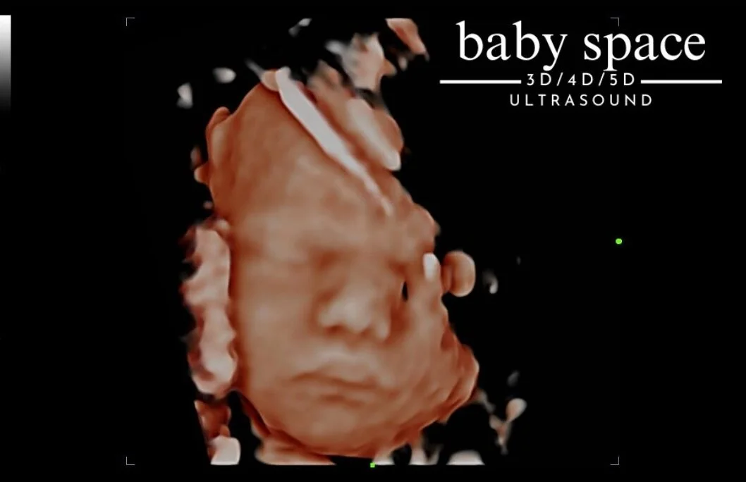 Baby Space - 3D/4D/5D ultrasound
