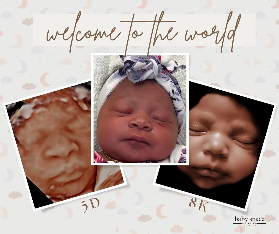 Baby Space - 3D/4D/5D ultrasound