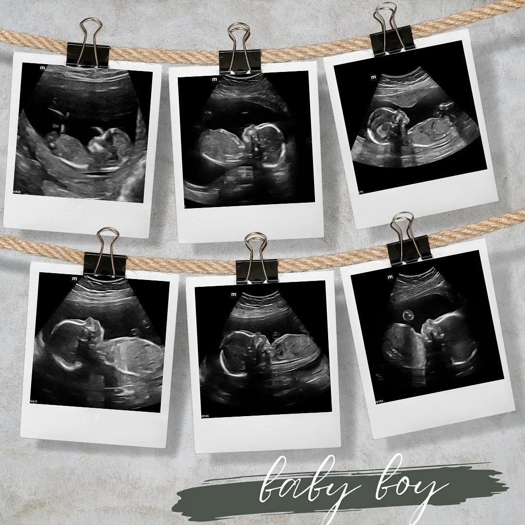 Baby Space - 3D/4D/5D ultrasound