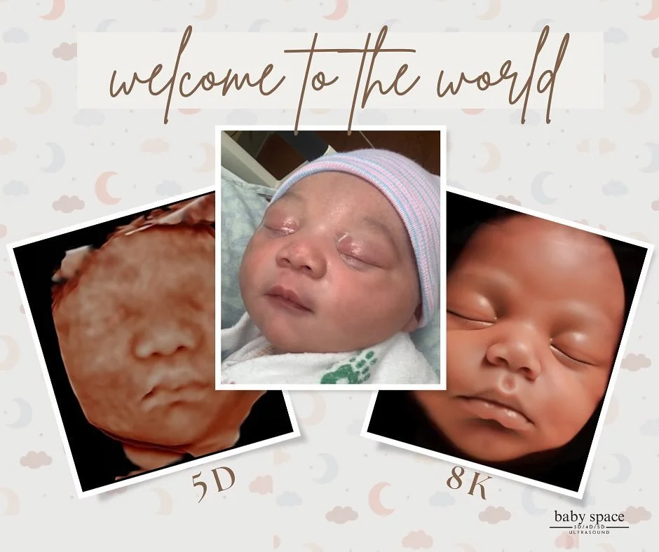 Baby Space - 3D/4D/5D ultrasound