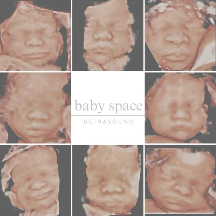 Baby Space - 3D/4D/5D ultrasound