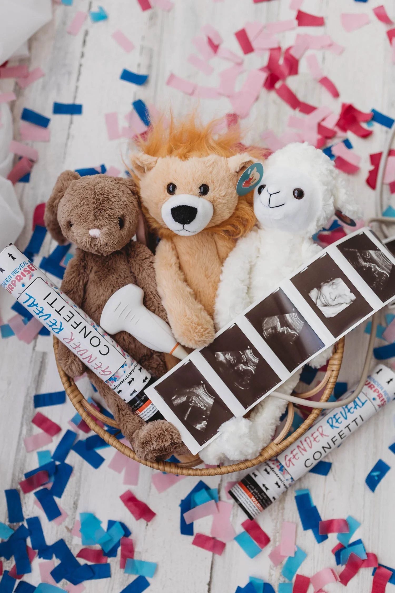 Baby Space - 3D/4D/5D ultrasound