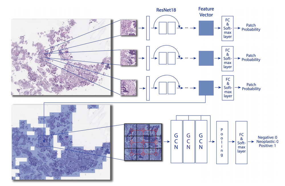 Graph Convolutional Neural Networks for Histologic Classification of ...