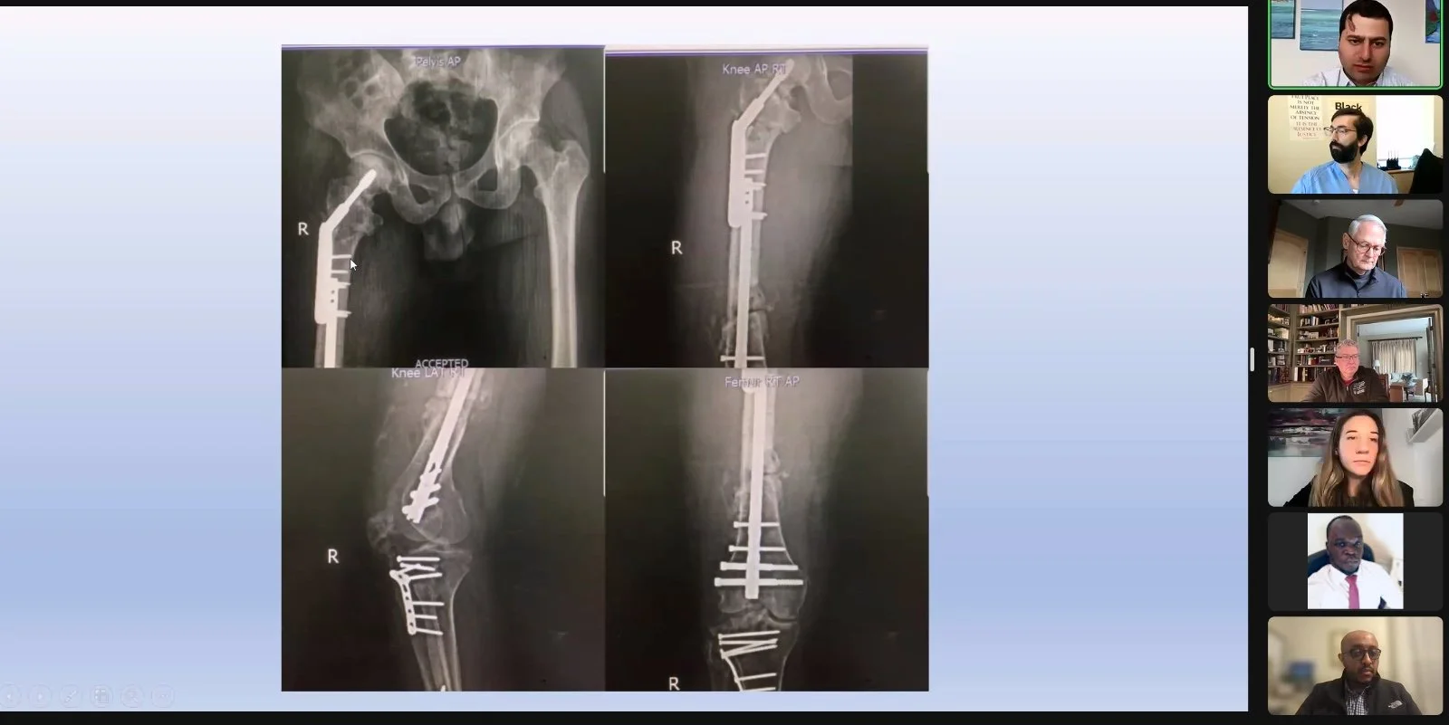 Harvard Global Orthopaedics Collaborative — Harvard Combined ...