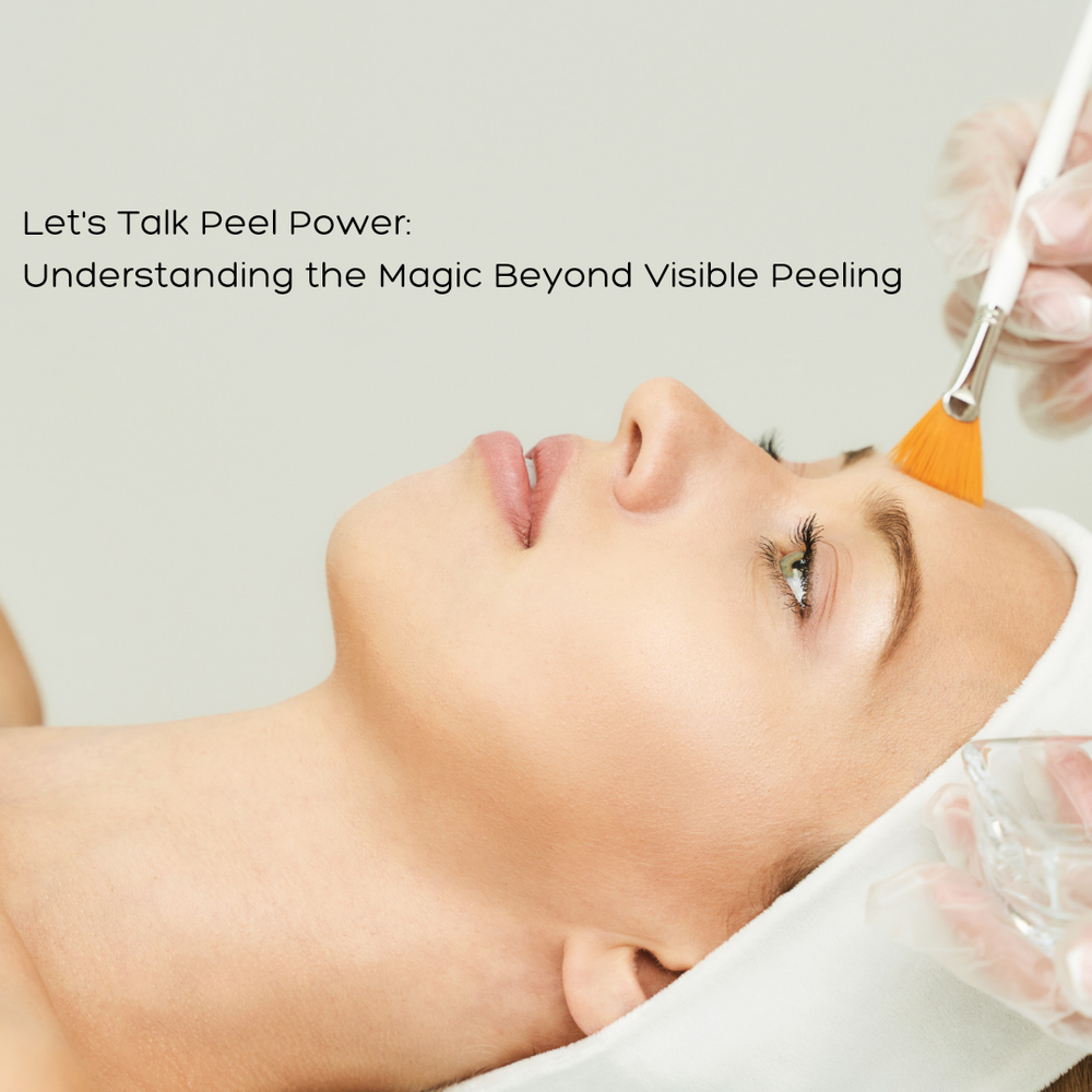 Let's Talk Peel Power: Understanding the Magic Beyond Visible Peeling ...