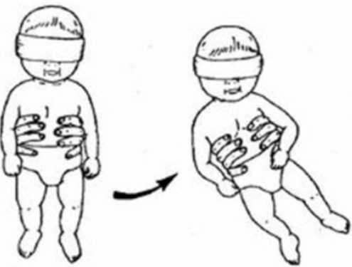 Righting Reflex — BodyXTherapy