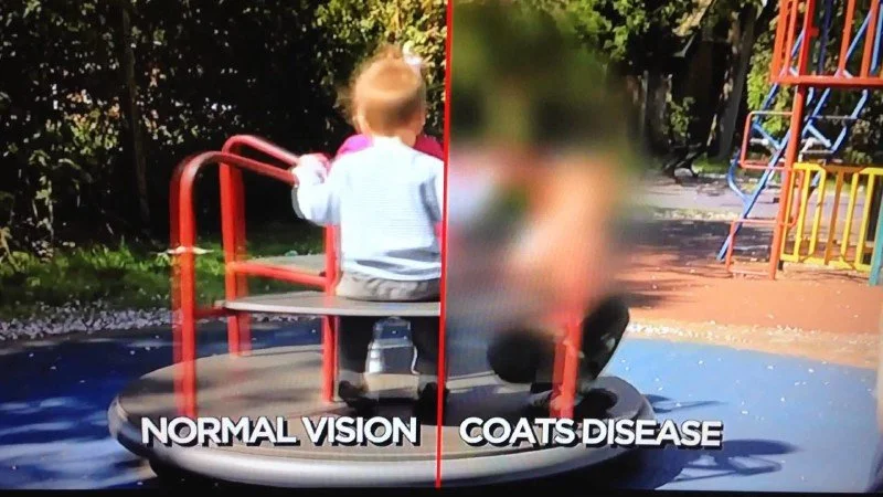 What is Coats' Disease? — Jack McGovern Coats' Disease Foundation