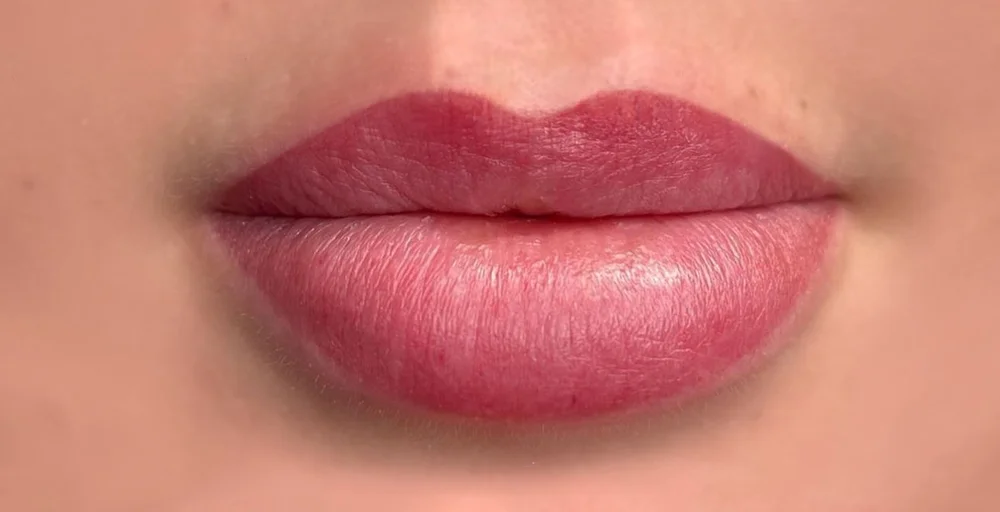 Aftercare Management Lips | Enhance Your Look - Get Expert Lip Care ...