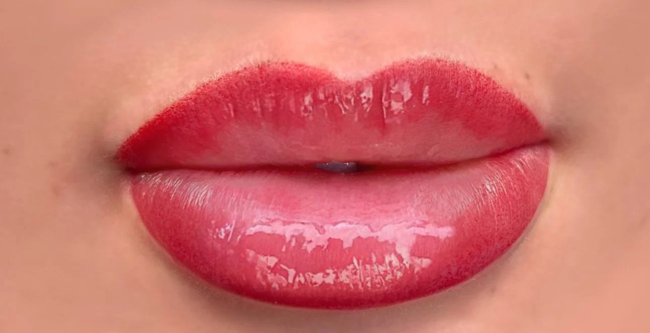 Aftercare Management Lips | Enhance Your Look - Get Expert Lip Care ...