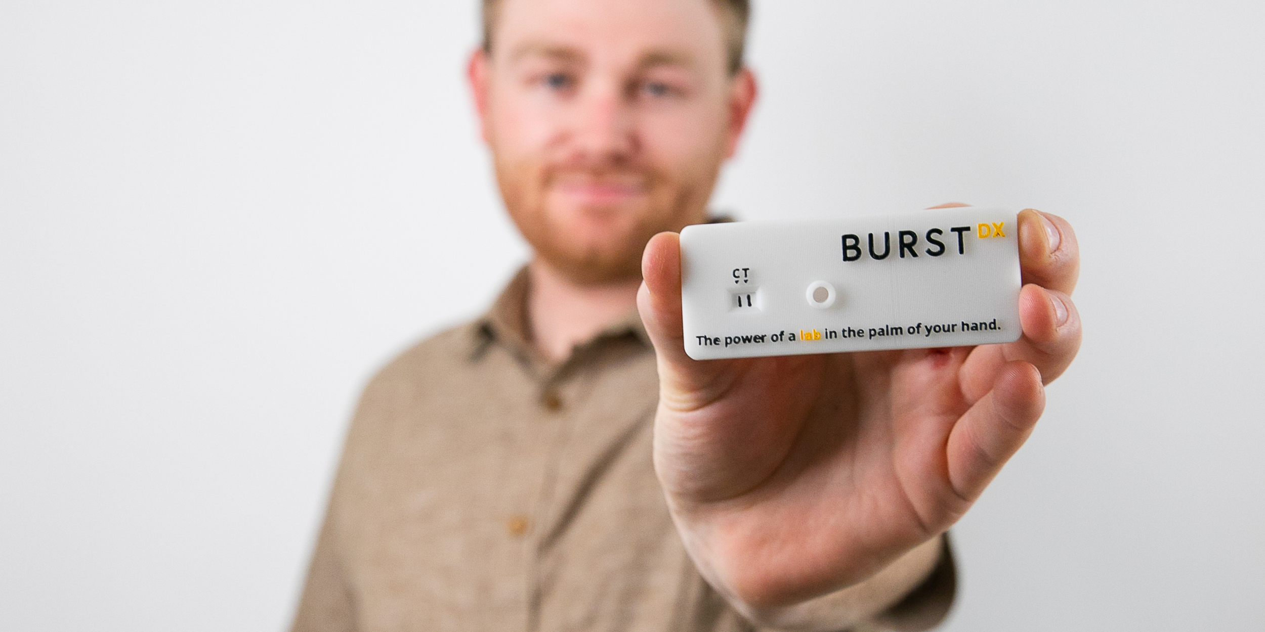 Home | Burst Diagnostics