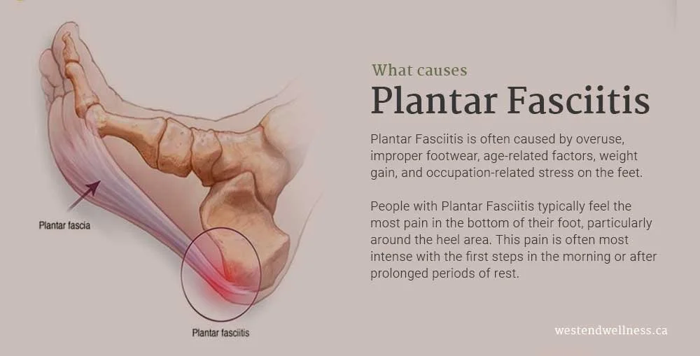 Plantar Fasciitis | Understanding the Pain in Your Feet