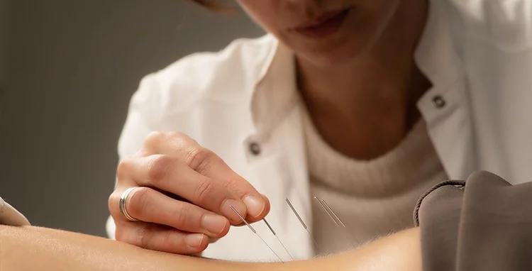 Acupuncture for Hormone Health: Balancing Women's Wellness