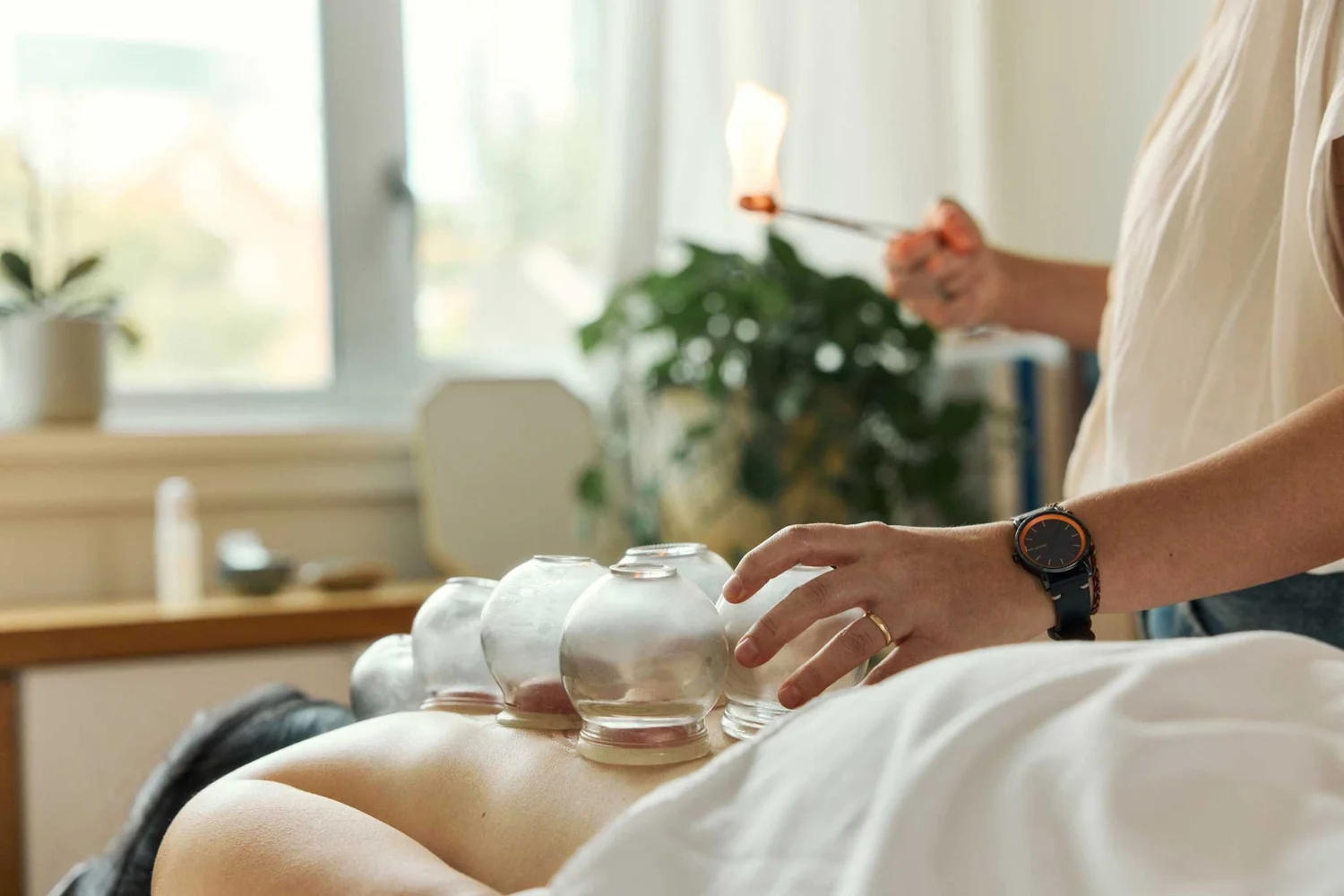 Cupping Therapy Vancouver Experience the Healing Power