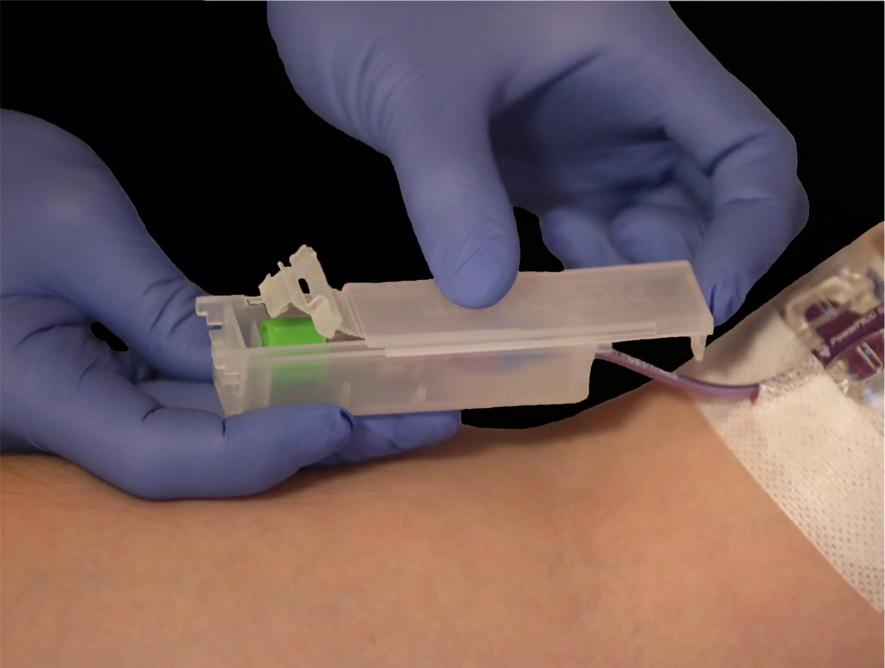 How to Use — PICC Guard