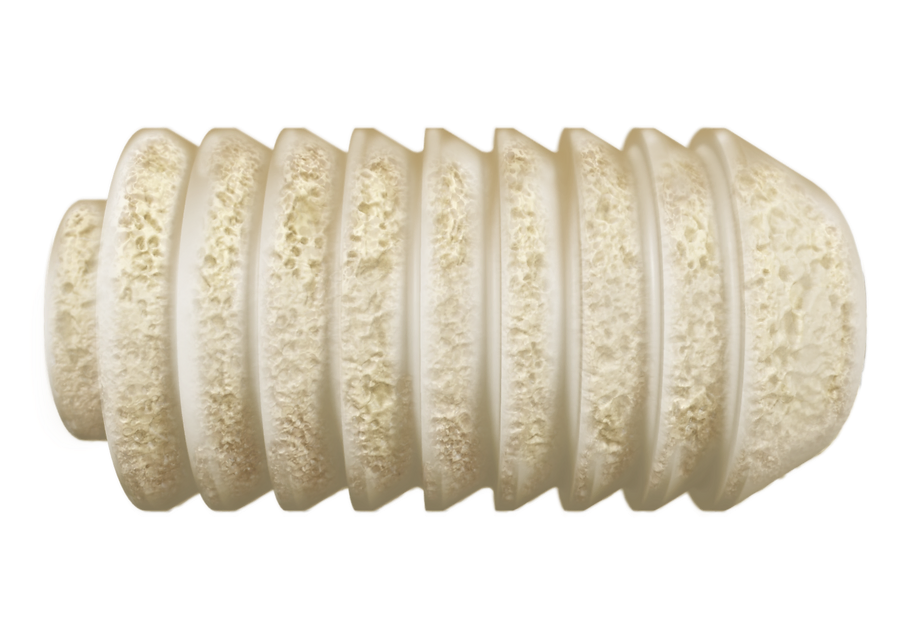 Pain Solutions — SiFix