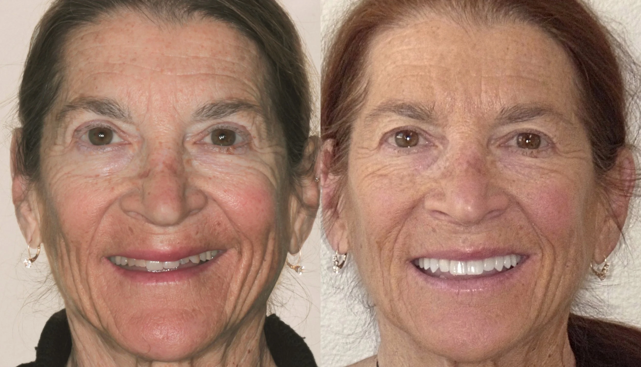 The Ageless Smile