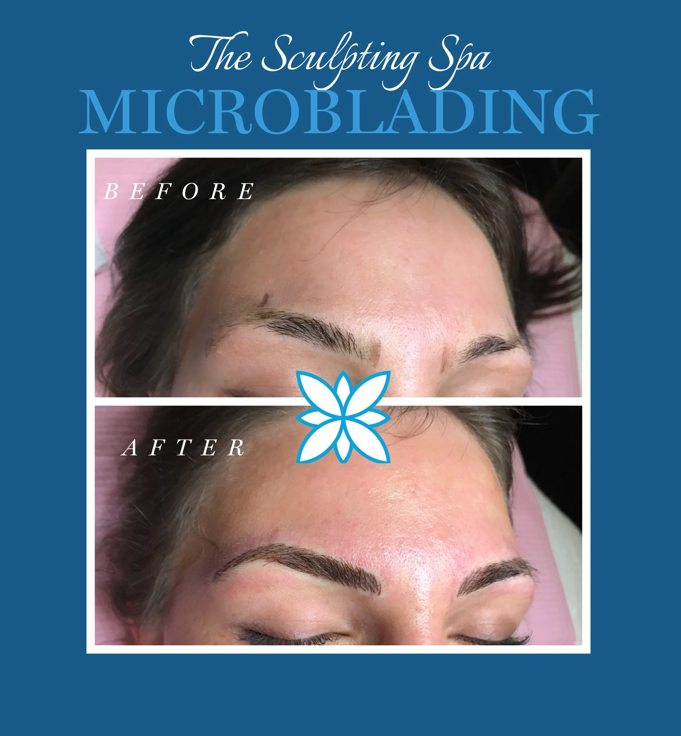 Services — The Sculpting Spa