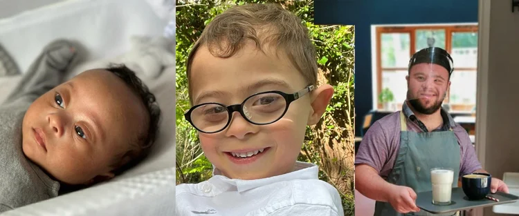 Down Syndrome Integrated Care Pathway