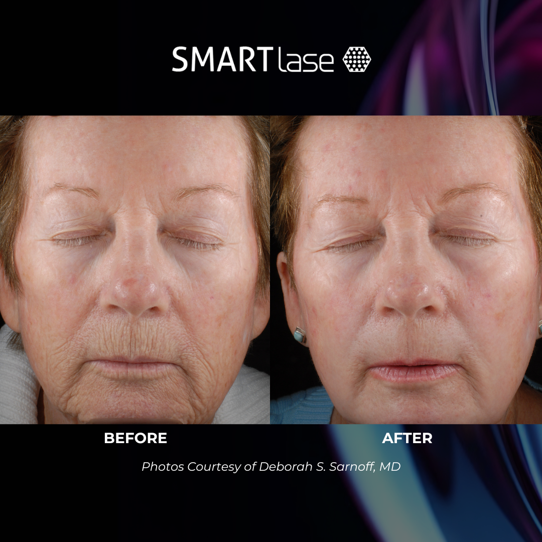 Dive Into Our Elite Portfolio — Monarch Aesthetic Services