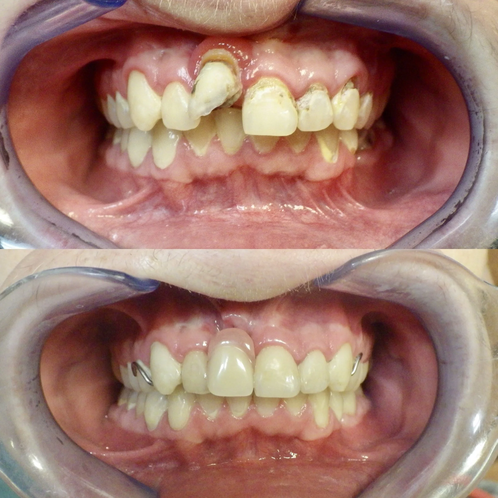 Before & After's — Teeth and things