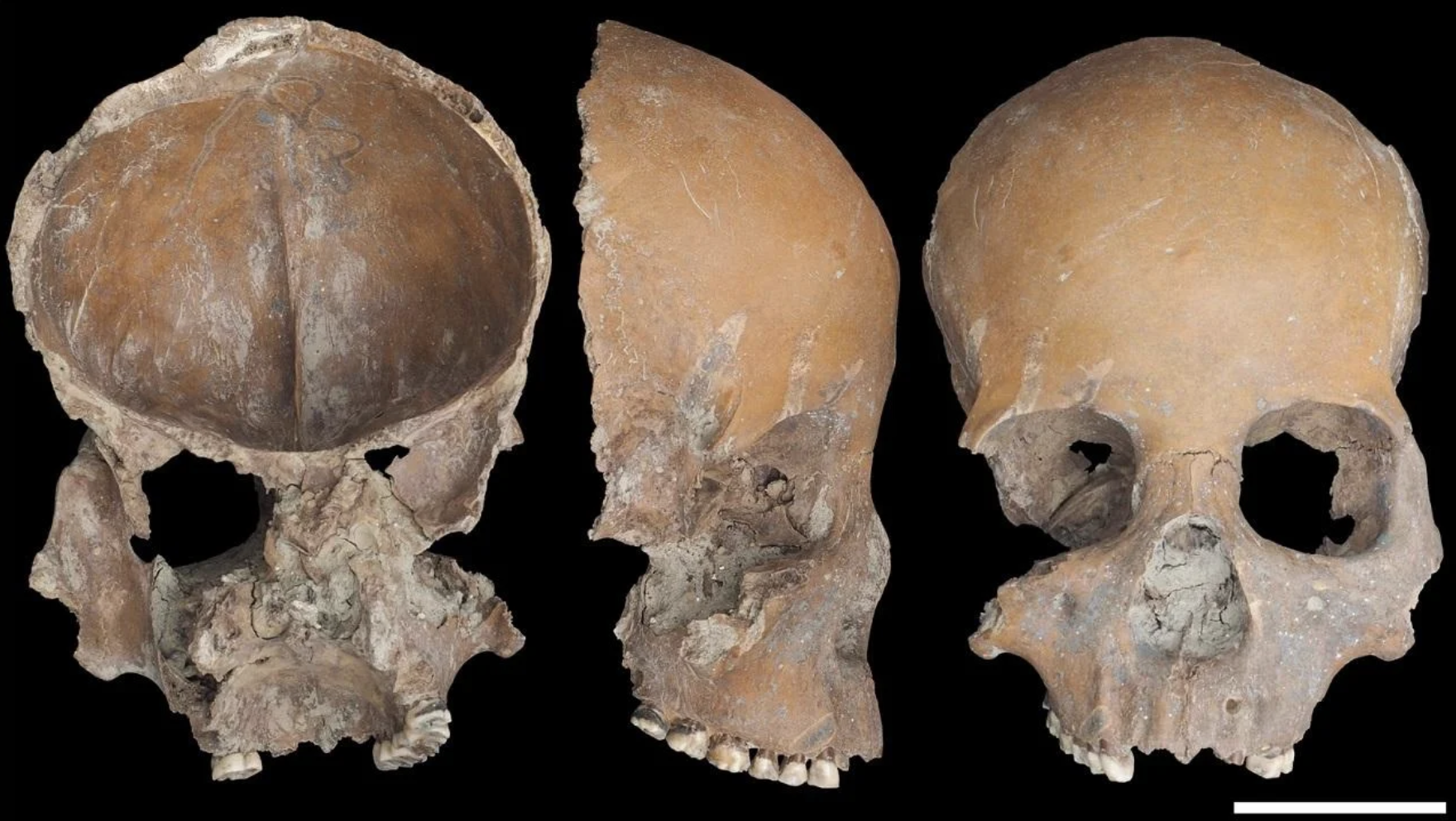How Neolithic China’s Liangzhu People Shaped Human Bones! — My Classics ...