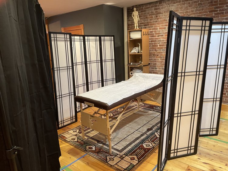 AcupunctureME
