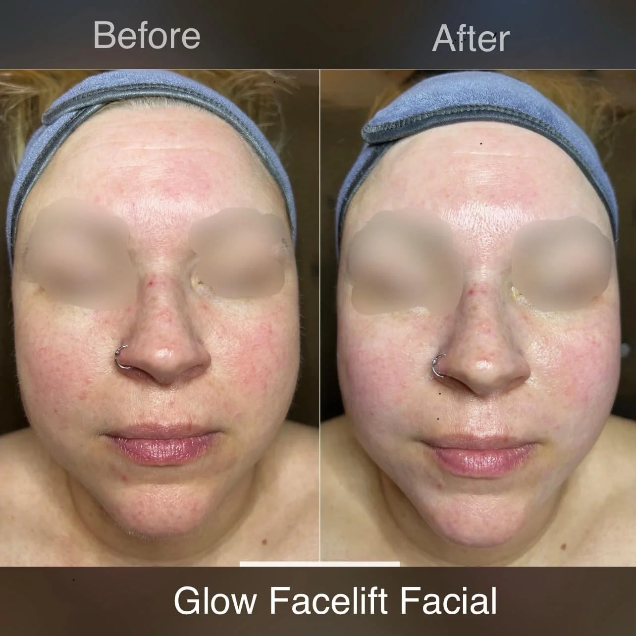 Face Haven Facial Studio