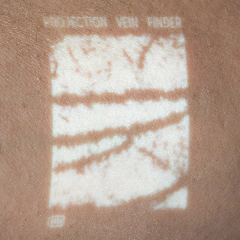 Affordable High-Performance Vein Finder | NextVein Australia